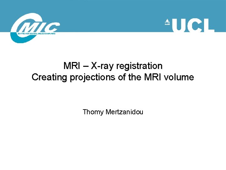 MRI Xray registration Creating projections of the MRI