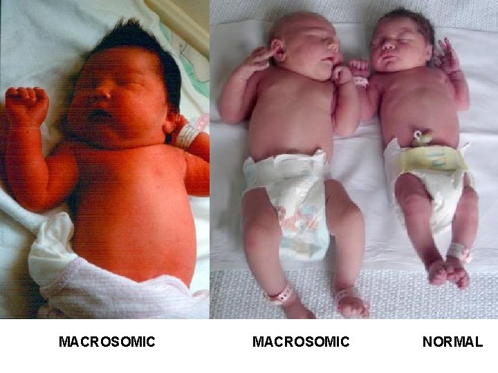 NONOBSTETRICAL COMPLICATIONS DURING PREGNANCY DIABETES MELLITUS DURING ...