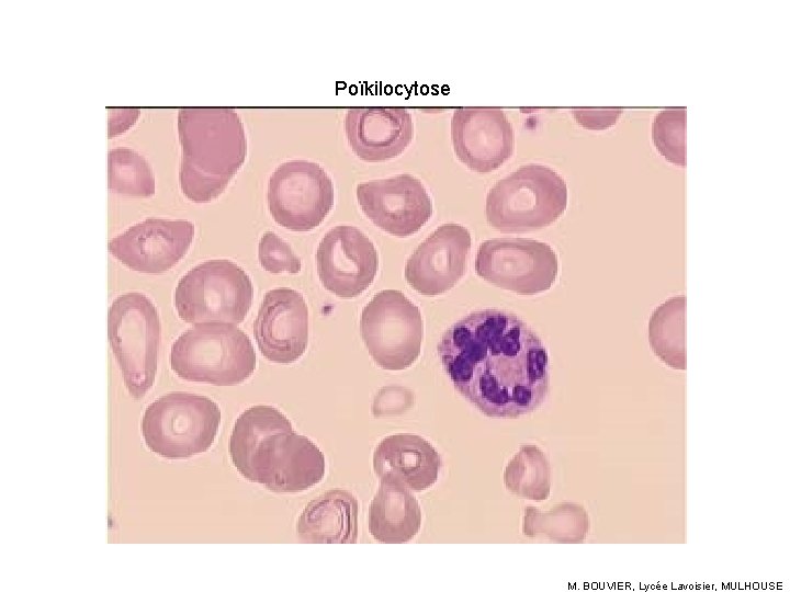 ANOMALIES DES GLOBULES ROUGES M BOUVIER Lyce Lavoisier