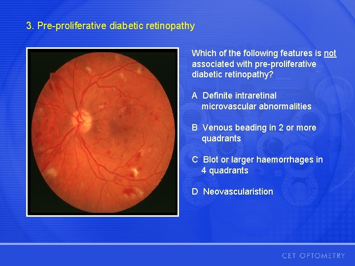 MCQ Picture Quiz Retina 1 1 Diabetic retinopathy
