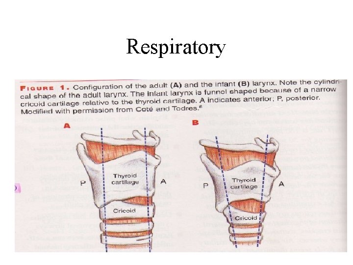 Surgery in Children Ioana Bratu MD Pediatric General