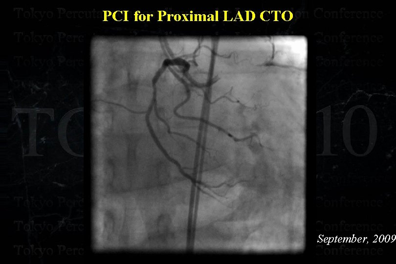 The most important factor to determine the results