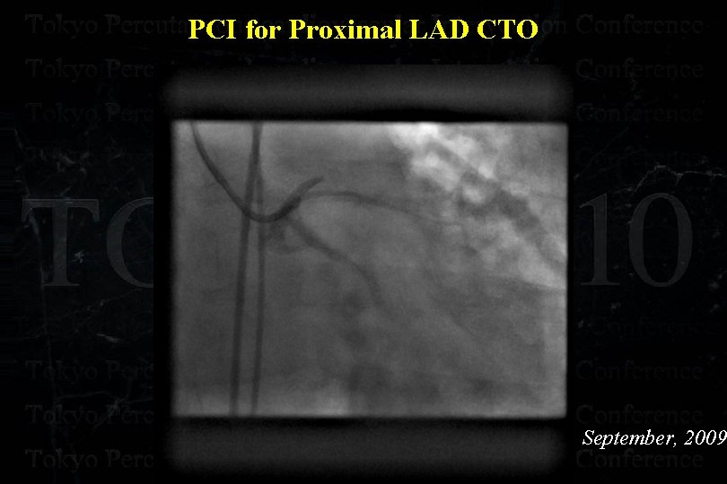 The most important factor to determine the results