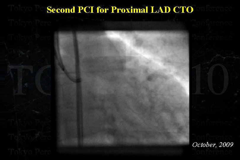 The most important factor to determine the results