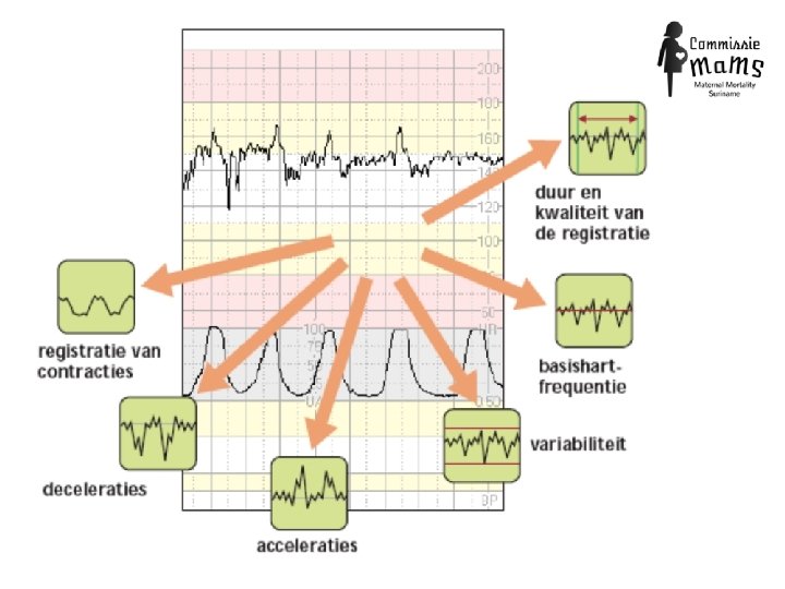 CTGinterpretatie Nationaal Obstetrisch Congres April 2019 Foetale ...