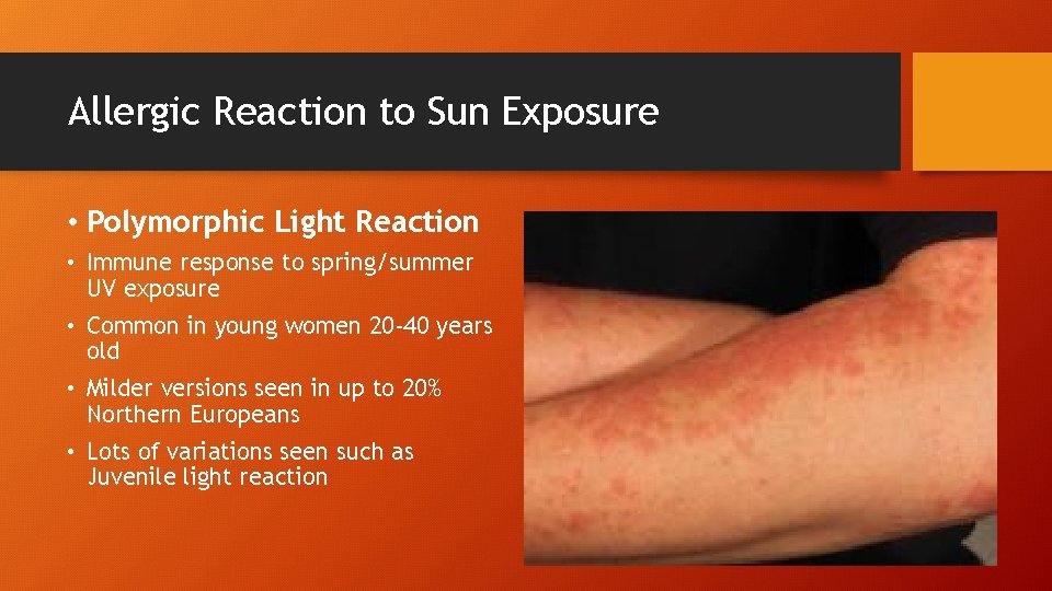 Sun Skin Dr Robin Pullen UV light from