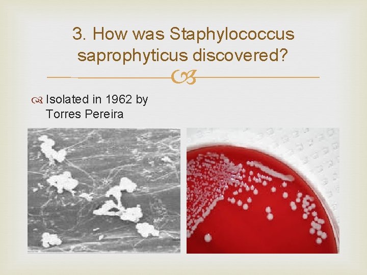 Staphylococcus saprophyticus The Honeymooners UTI Austin Stutts 411