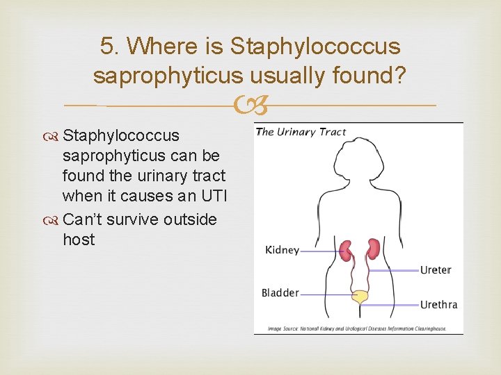 Staphylococcus saprophyticus The Honeymooners UTI Austin Stutts 411