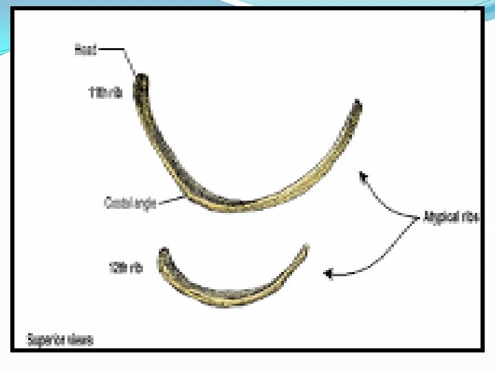 General Features And Attachments Of Typical Ribs Atypical