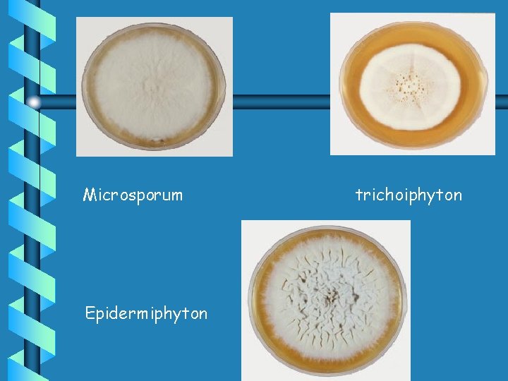 SUPERFICIAL MYCOSES b Dermatophytosis b Pityriasis versicolor b