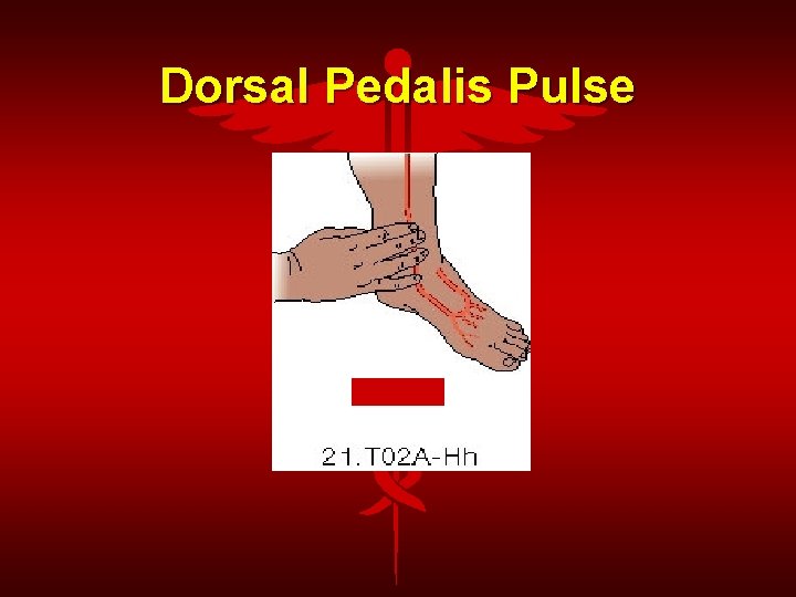 DISEASES AND DISORDERS OF BLOOD Anemia Too few