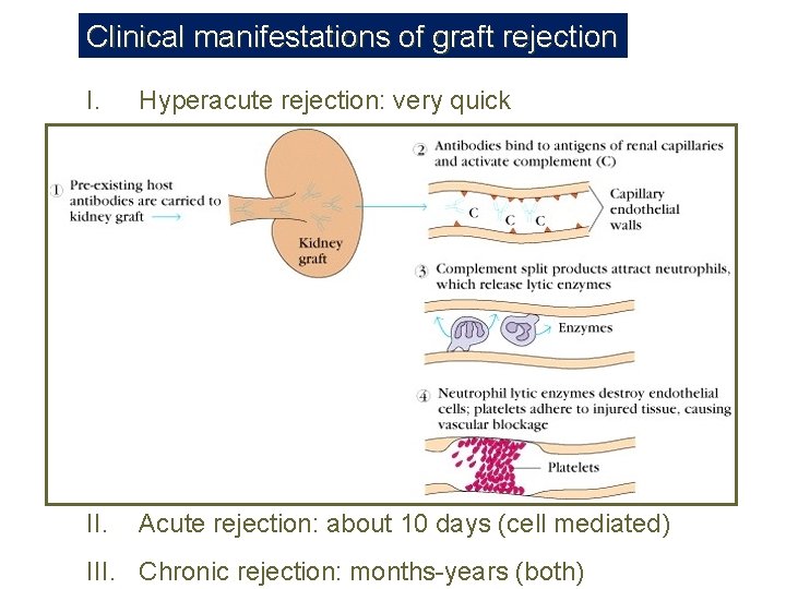 Immunology of transplantation Major Histocompatability Complex and ...
