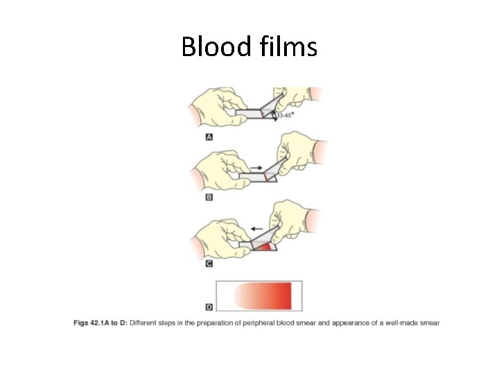 Procedures pediatrics emergencies BagMask Ventilation INDICATIONS To ...