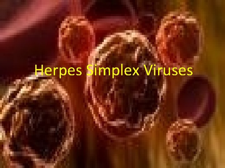 Herpes viruses Properties of herpesviruses Enveloped double stranded