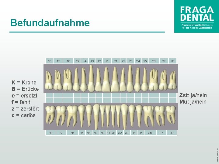 Study Club Endodontie the one and only Fallprsentation