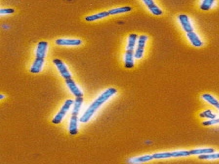 Bacillus cereus Caratteristiche generali Il Bacillus cereus un