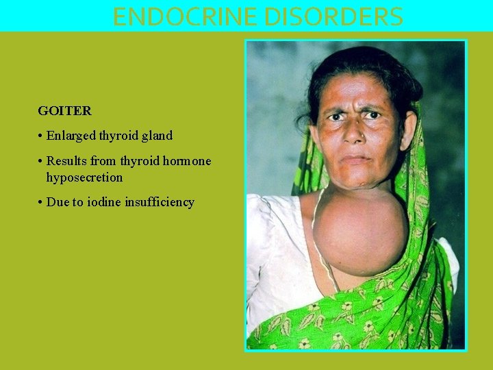 ENDOCRINE SYSTEM Regulates body functions via hormones secreted