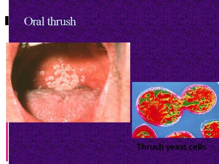 DEFENCE AGAINST DISEASES Objectives The student understands what