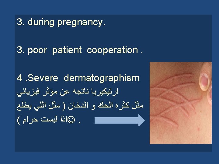 Diagnosis of type 1 allergy Prof Mohamed Osman