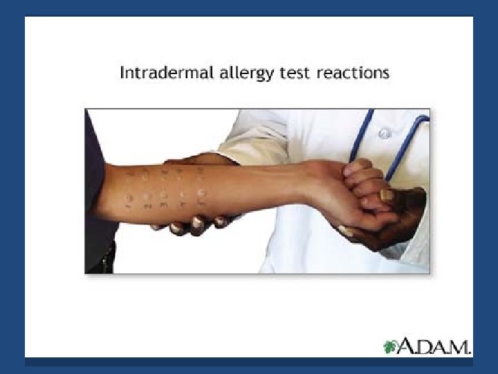 Diagnosis of type 1 allergy Prof Mohamed Osman