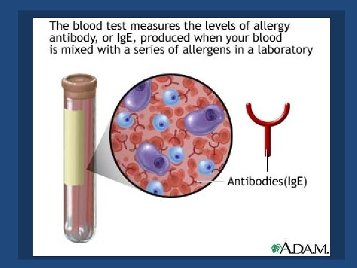 Diagnosis of type 1 allergy Prof Mohamed Osman