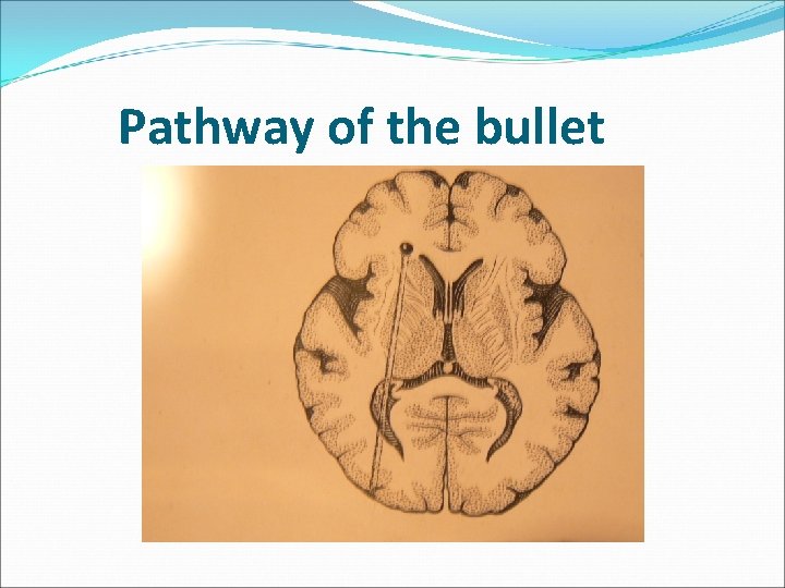 Alterations in Cognitive Systems Cerebral Hemodynamics and Motor