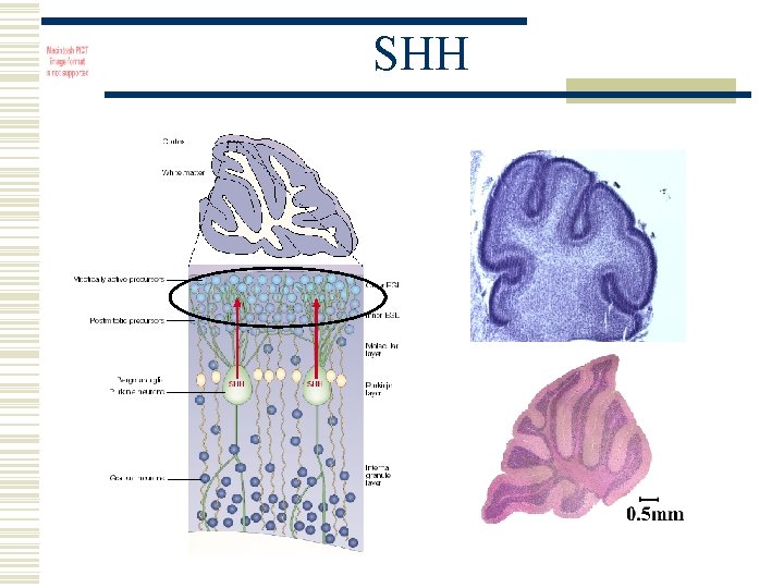 Analyzing Gene Relationships for Down Syndrome with Labeled