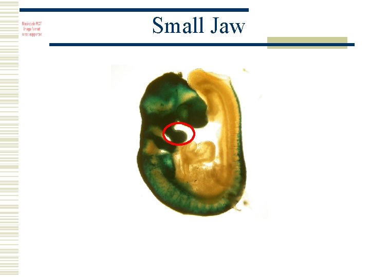 Analyzing Gene Relationships for Down Syndrome with Labeled