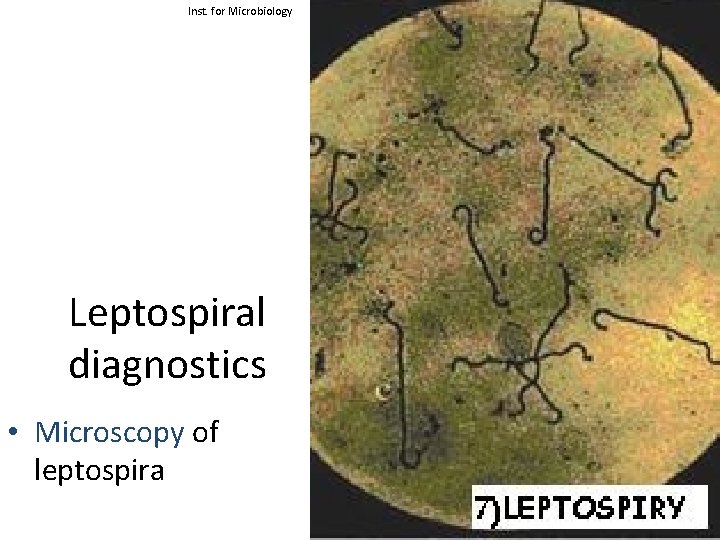 Institute for microbiology shows TRACING THE CULPRIT L