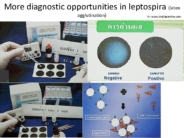 Institute for microbiology shows TRACING THE CULPRIT L