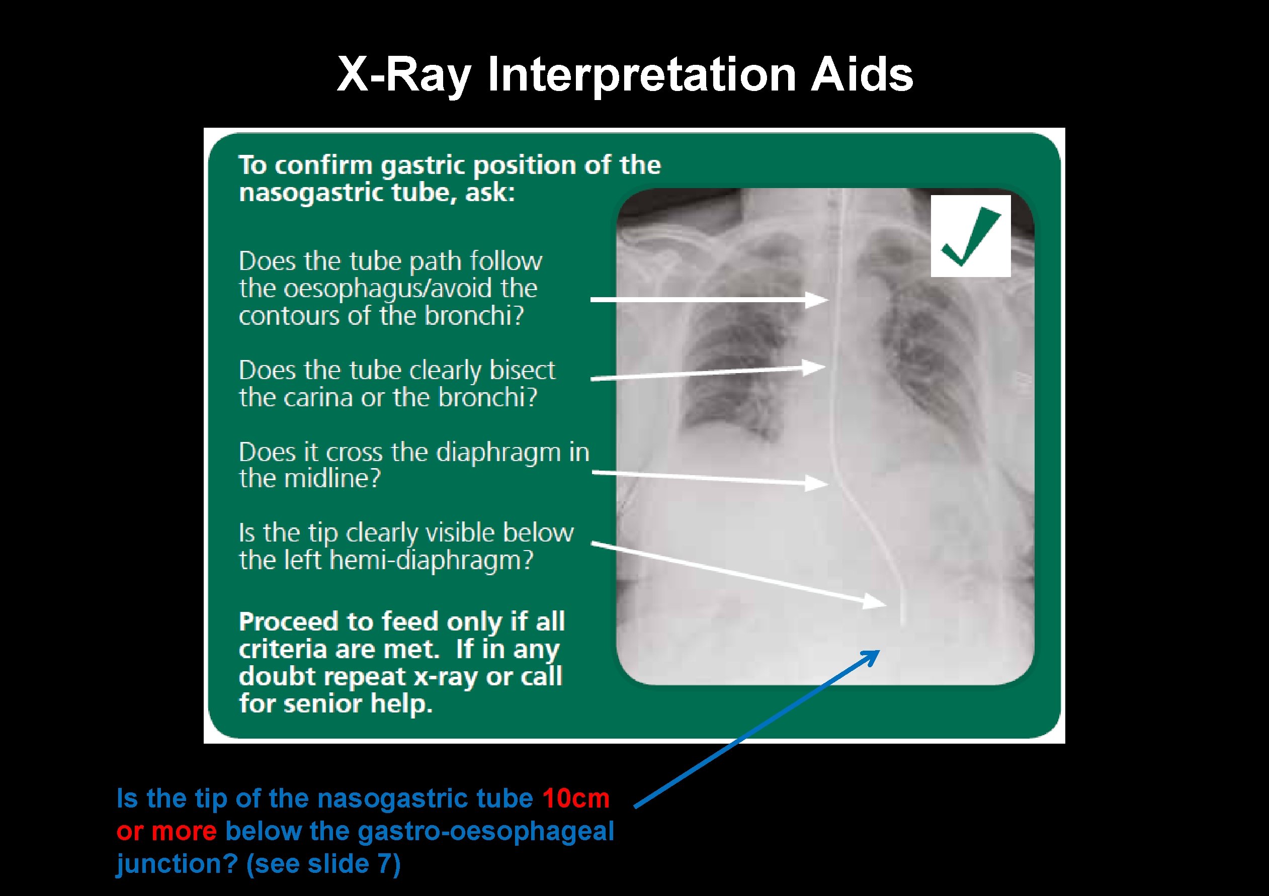 RADIOLOGY DEPARTMENT NASOGASTRIC TUBE PROTOCOL All nasogastric tube