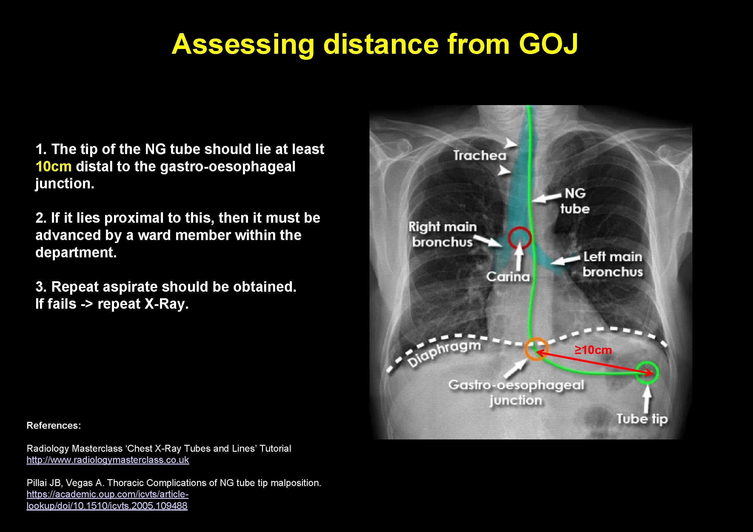 RADIOLOGY DEPARTMENT NASOGASTRIC TUBE PROTOCOL All nasogastric tube