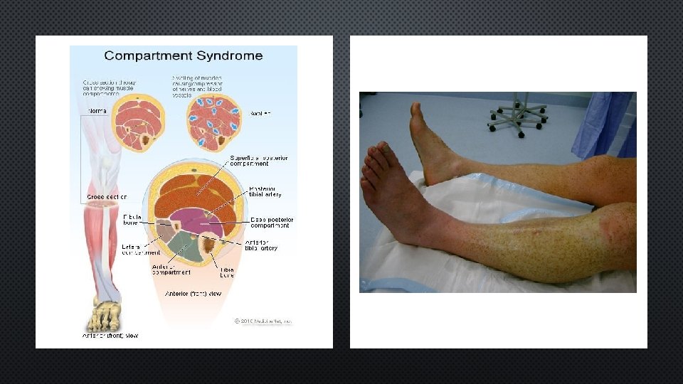 LIGAMENT INJURIES LATERAL AND MEDIAL ANKLE SPRAINS ABOUT