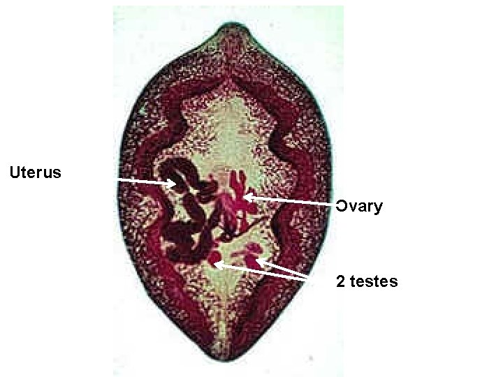 Lab 6 Trematodes Fasciola hepatica Adult worm in