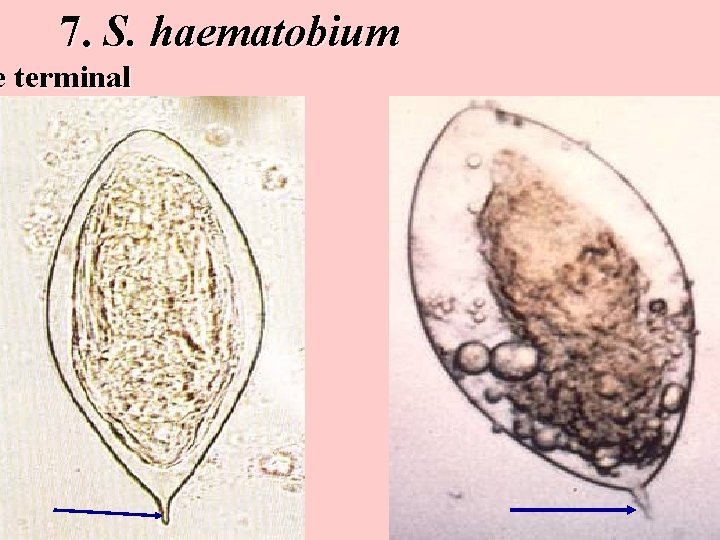 Lab 6 Trematodes Fasciola hepatica Adult worm in