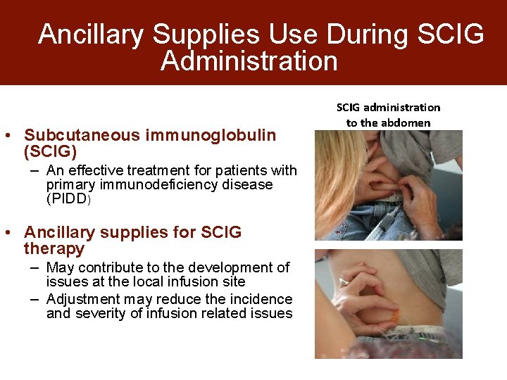 Importance of Ancillary Supplies for Subcutaneous Immunoglobulin Infusion