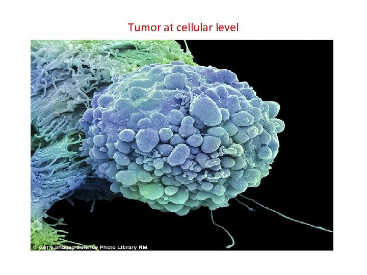 Potential clinical impact of laseraccelerated beams in cancer