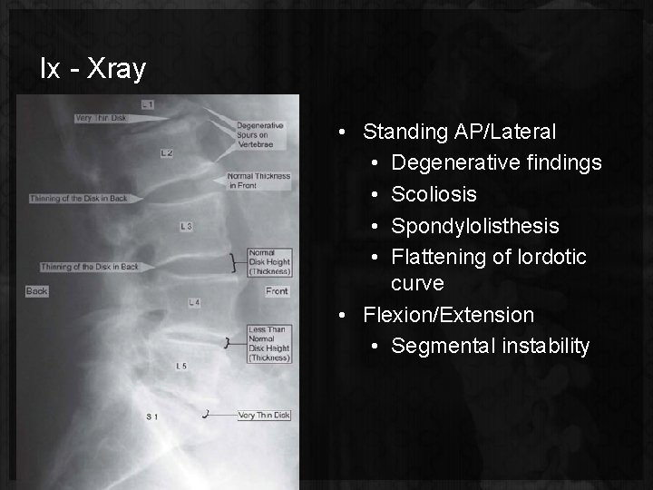 Lumbar Spinal Stenosis KTPH Orthopaedics Spine Teaching Anshuja