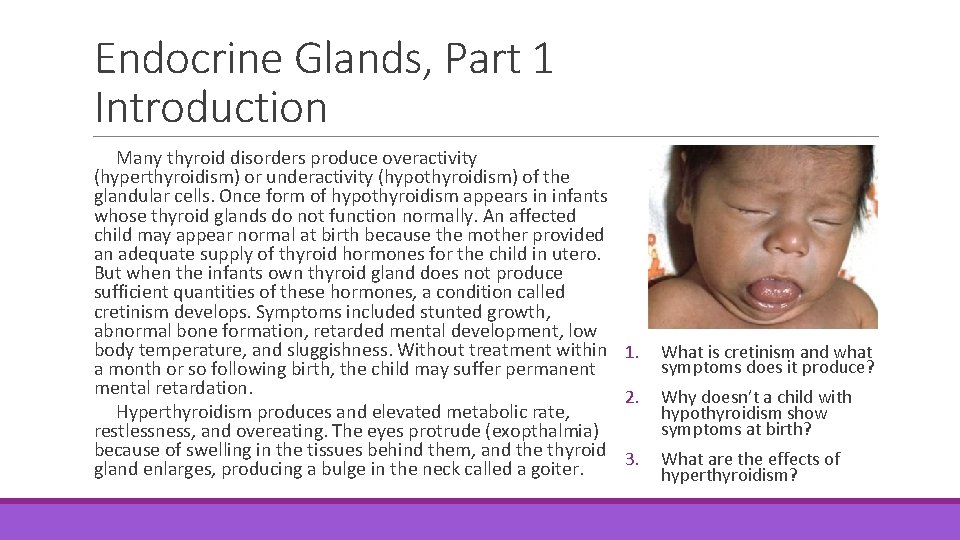Endocrine Glands Part 1 Introduction Many thyroid disorders