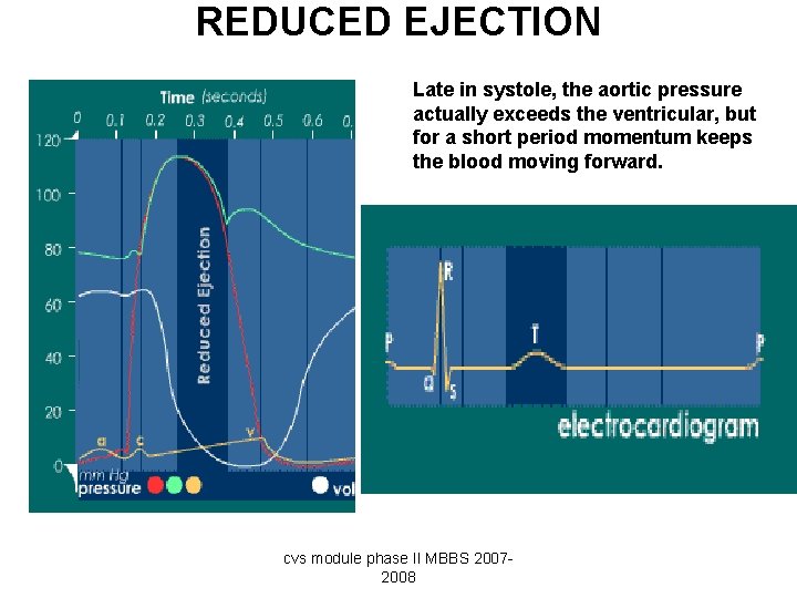 CARDIAC CYCLE PHYSIOLOGY CARDIOVASCULAR MODULE PHASE II 2007