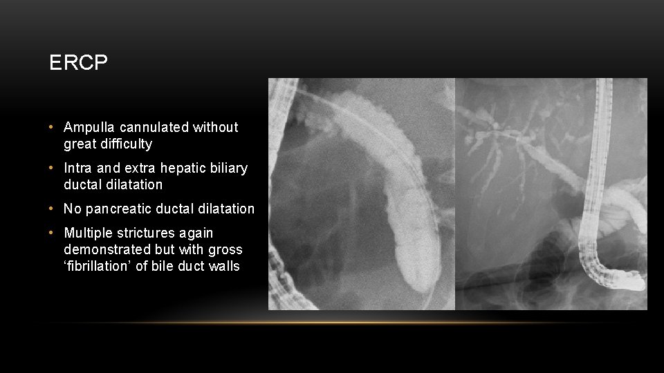 WHEN THE DIFFERENTIAL IS OTHER BACK TO THE