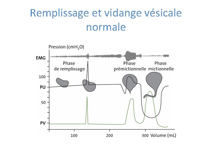 Le Bilan UroDynamique Wierre Effroy le 25 mai