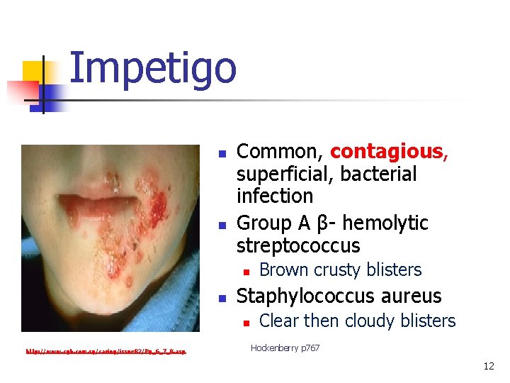 Skin problems n n n n Dermatitis Bacterial