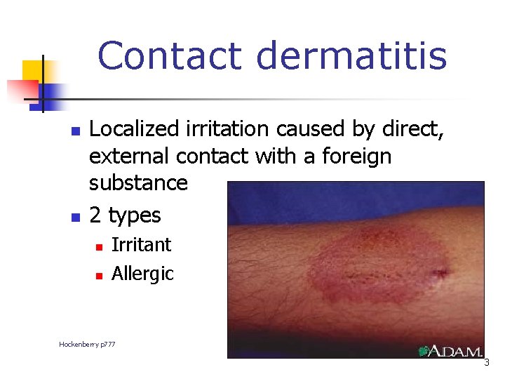 Skin problems n n n n Dermatitis Bacterial