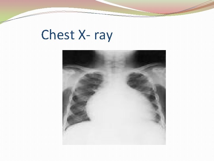 Heart Failure Objectives 1 to know the common