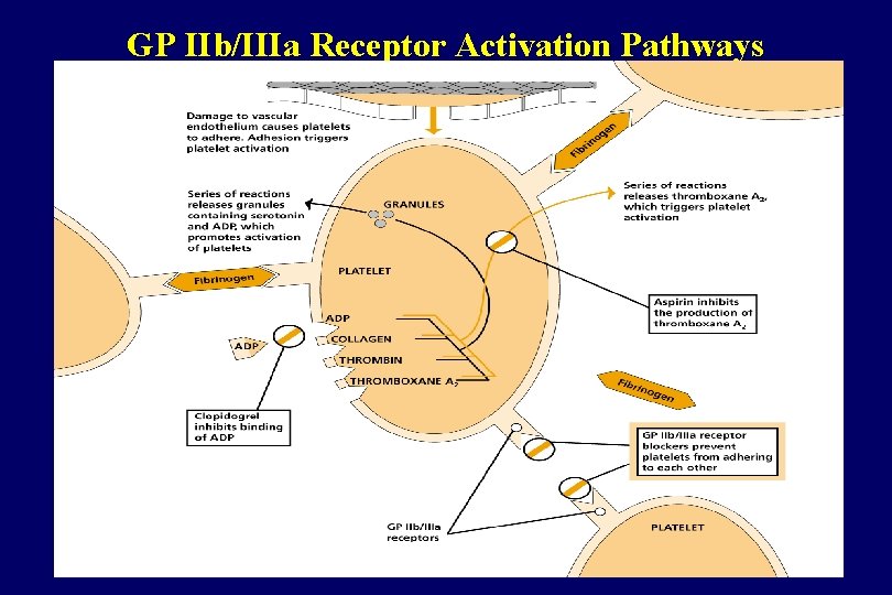 New Treatment Advances in Acute Coronary Syndrome Objectives