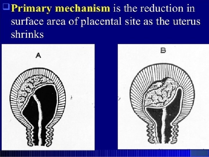 THIRD STAGE OF LABOUR DEFINITION Third stage is
