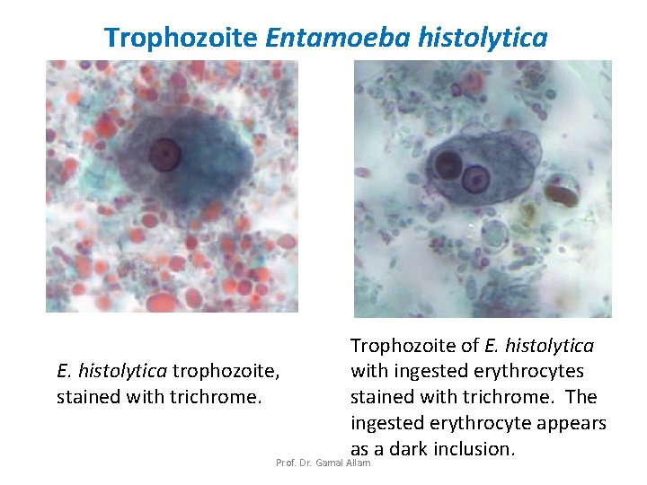 Practical Protozoa Prof Dr Gamal Allam Cysts Entamoeba