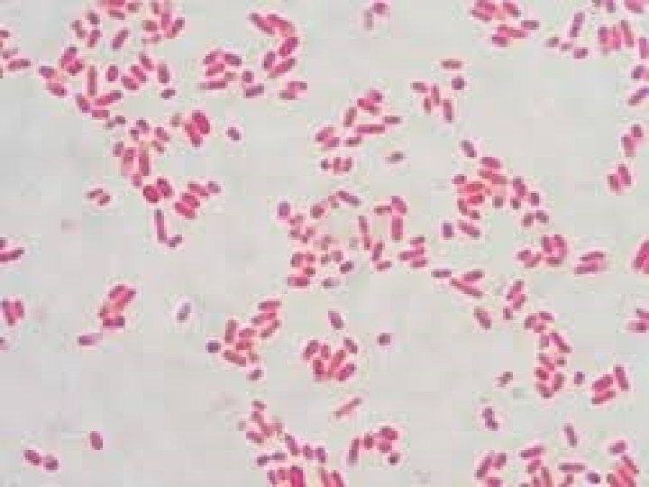 Avian colibacillosis E coli infections Definition It is