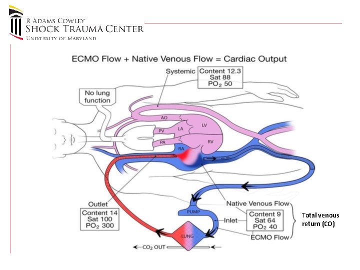 Physiology of VenoVenous ECMO Sam Galvagno D O